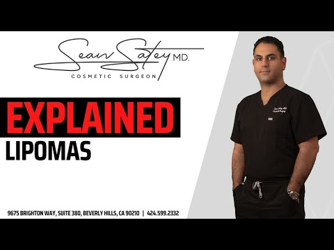 Lipomas: Explained
