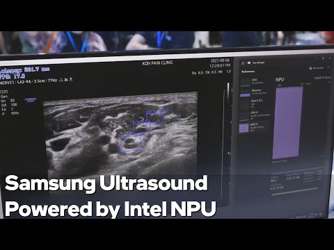 Intel at Computex 2024: NPU-Powered Samsung Ultrasound Demo | Talking Tech | Intel Technology