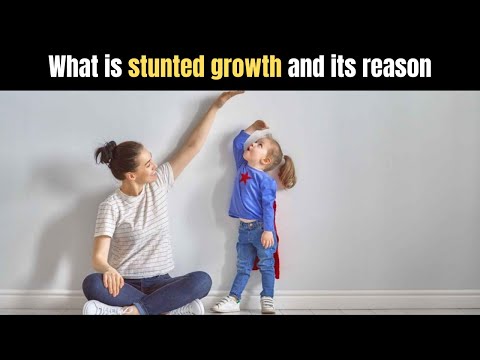 What is stunted growth and its reason |Urdu/Hindi| Nutritionist Haris Anees