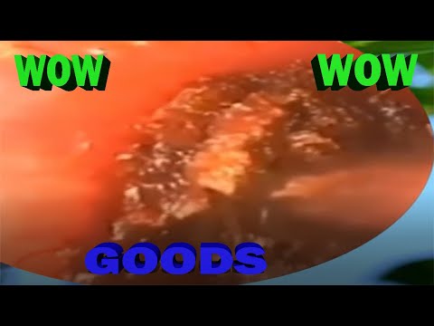 Remove the wax according to the doctor's instructions for health and beauty-EP#323