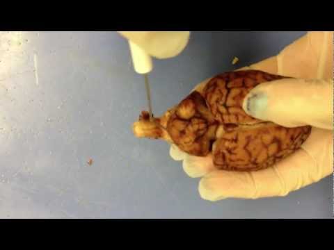 Sheep Brain Dissection: Part 1/7 - Dorsal & Lateral