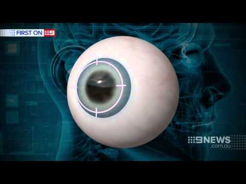 Dr Genge on 9 News - New lens implant brings clarify to cataract suffers