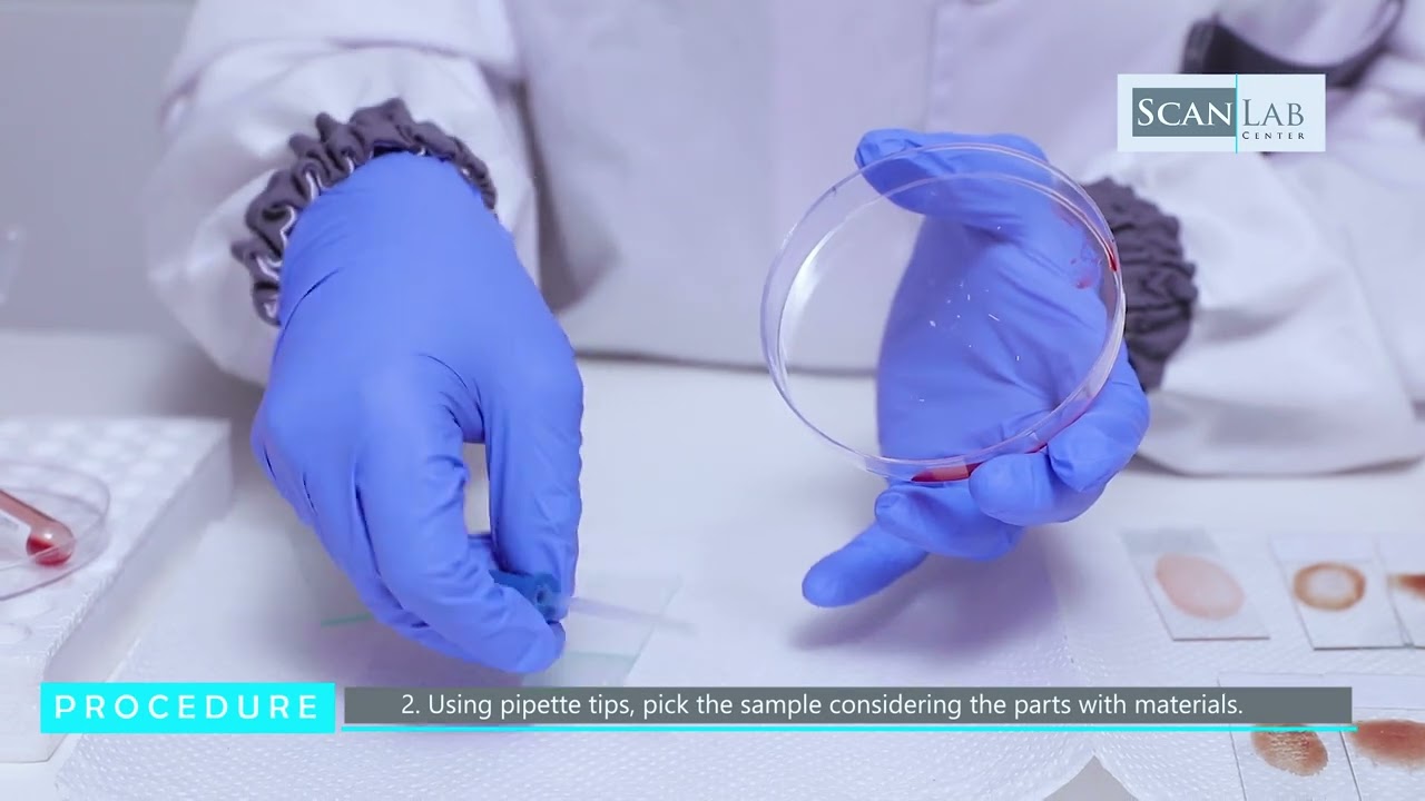 PREPARATION OF BONE MARROW ASPIRATE BMA SMEARS