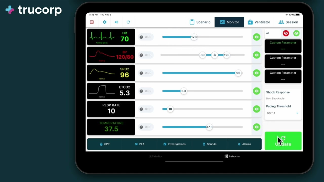 TruMonitor Quick Start - Standalone Mode