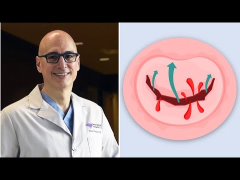 Mitral Valve Disease: The Different Faces & Treatment Options