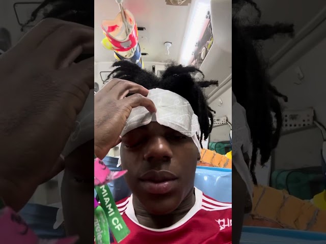 Is IShowSpeed okay? Streamer undergoes emergency surgery in hospital ...