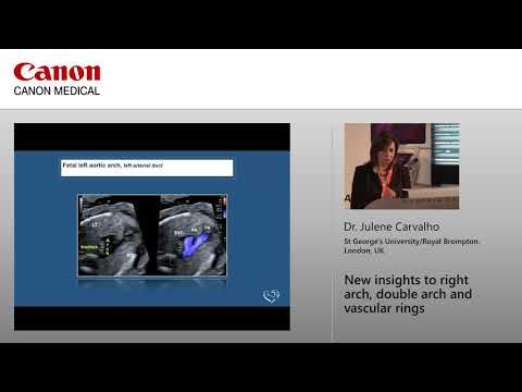 Dr Julene Carvalho - New Insights to Right Arch, Double Arch and Vascular Rings