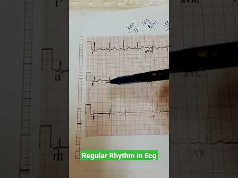 What Is Regular Rhythm In ECG Urdu Hindi | #Shorts #ECG #NormalRhythm