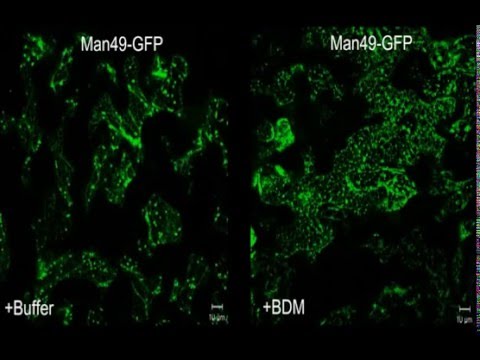 The ER-Membrane Transport System Is Critical for Intercellular Trafficking of the NSm Movement