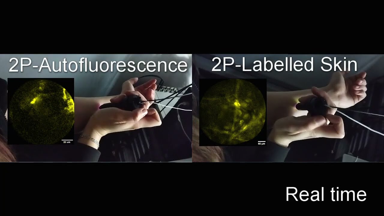 Multiphoton in vivo imaging with InSplorer endoscope