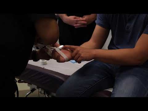 Application of Finger Splints