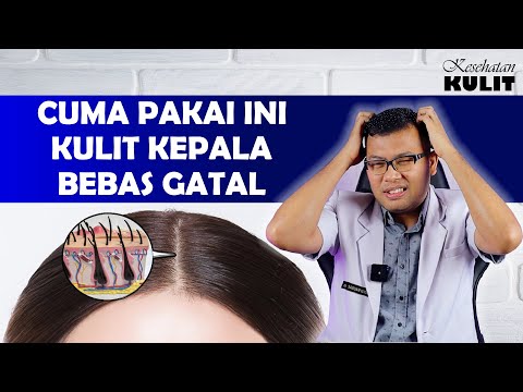 PENYEBAB KULIT KEPALA GATAL DAN SOLUSINYA - DOKTER SADDAM ISMAIL