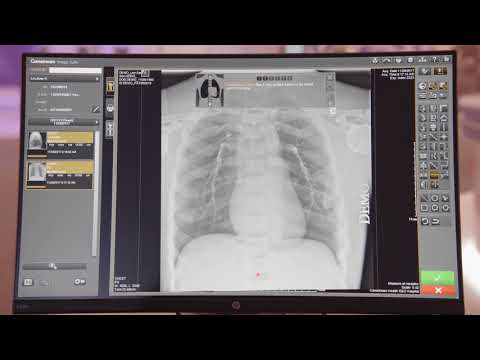 CARESTREAM Image Suite Software with DRX-Detector [X-ray Imaging]