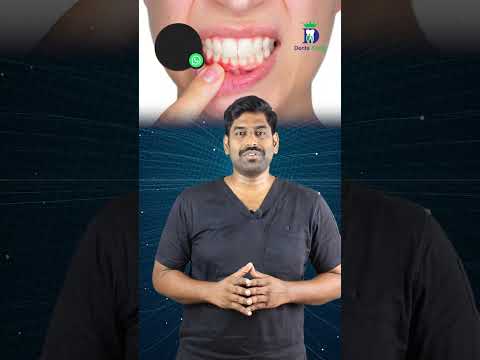ஈறு நோய் இருக்கிறதா என்று எப்படி கண்டுபிடிப்போம்? - How we diagnose gingivitis? | Denta Kings