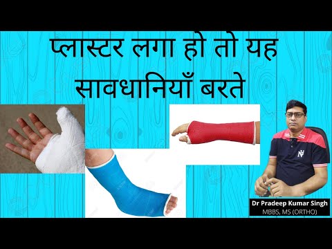 प्लास्टर लगा हो तो यह सावधानियाँ बरते/Precaution in plaster /Dr Pradeep Kumar Singh