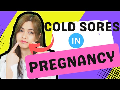 Pregnancy and Cold Sores (Pharmacist Approved Safe Treatments For Cold Sores)
