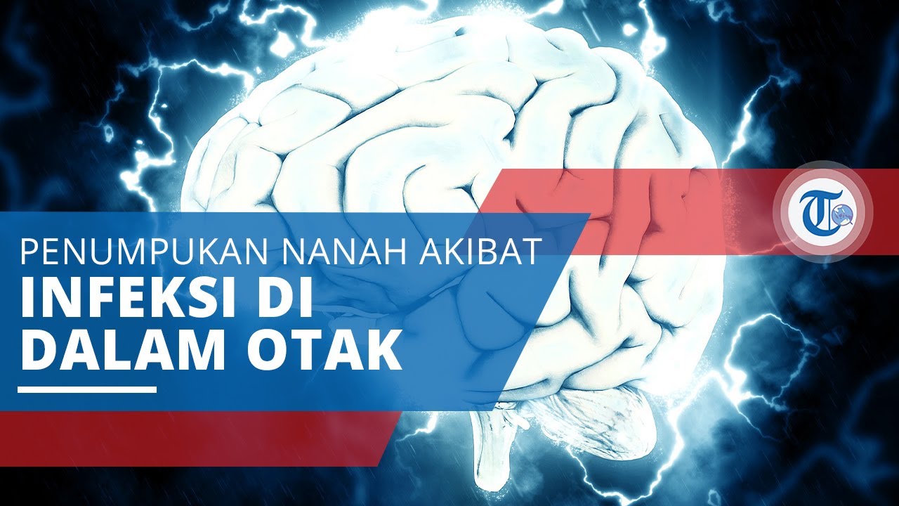 Abses Otak, Penumpukan Nanah akibat Infeksi di Dalam Otak Menyebabkan ...