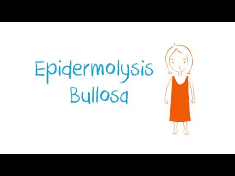 What is EB animation