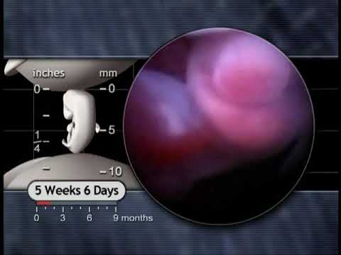 Abortion - Pro Life - Fetal Development Images
