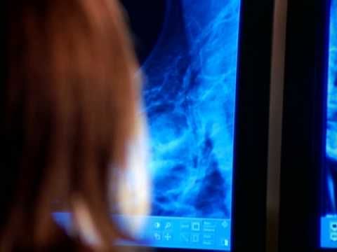GE's Digital Mammography Pitch