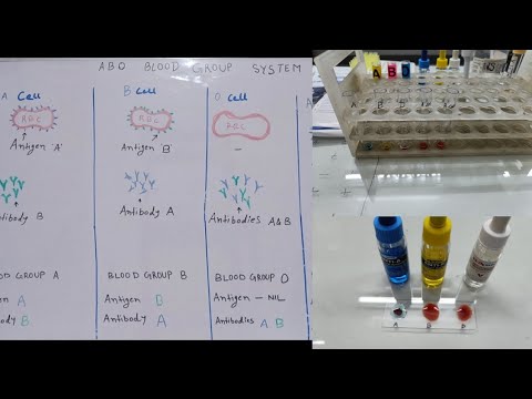 Blood Group Test Kit - Blood Grouping Kit Latest Price, Manufacturers ...