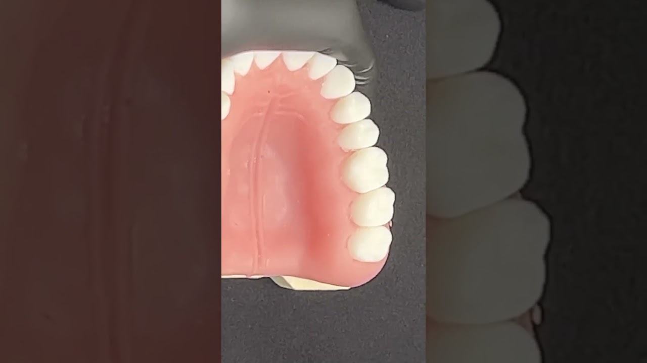 Harvest a Soft Tissue Graft in Less than 10 Seconds???