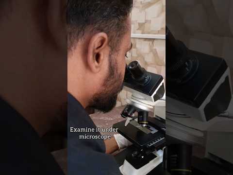 Urine Microscopy || Urine Examination || Urine Under Microscope #urineanalysis #urinetest #urine