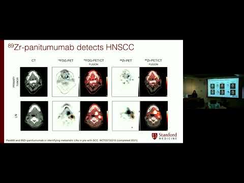 Precision Head and Neck Surgery with Intraoperative Molecular Imaging: Phase 2 Trials