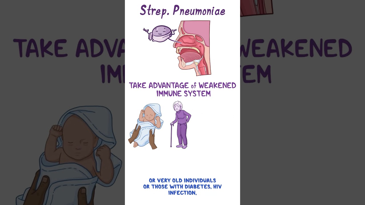 Clinical Cuts - Streptococcus pneumoniae