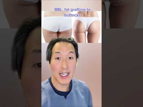 Did She Have a BBL? What is a BBL Anyway? #shorts #bbl