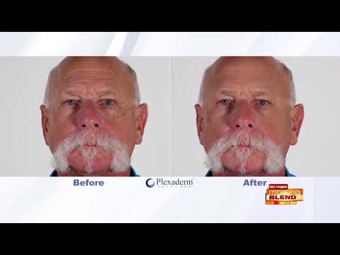 Get Rid Of Under Eye Bags