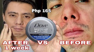 3 CORRECT TIPS | DOVE MEN+CARE ULTRA HYDRA MOISTURIZING WHITENING CREAM FOR ACNE & SCARS REVIEW