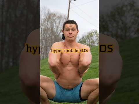 Hypermobile EDS @whealth_ #stayflexy