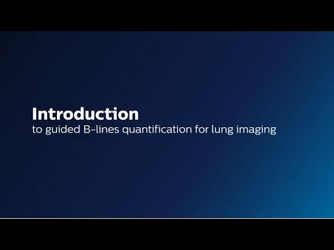 Introduction to guided B-lines quantification for lung imaging