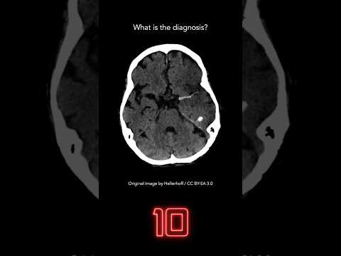 Brain CT Question 24