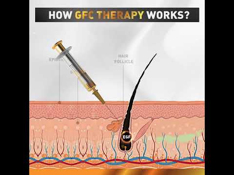 GFC Kit - Growth Factor Concentrate Kit Latest Price, Manufacturers ...