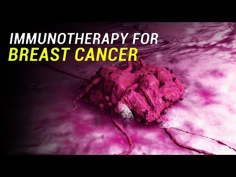 Immunotherapy Successfully Treats Advanced Breast Cancer