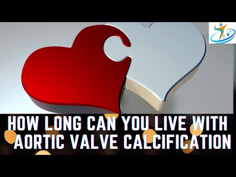 How Long Can You Live With Severe Aortic Valve Calcification