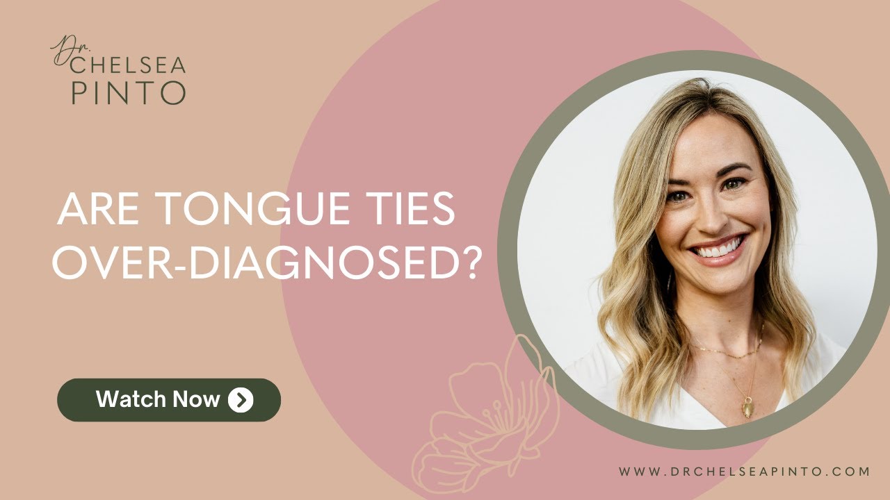 Are Tongue Ties Over-Diagnosed?