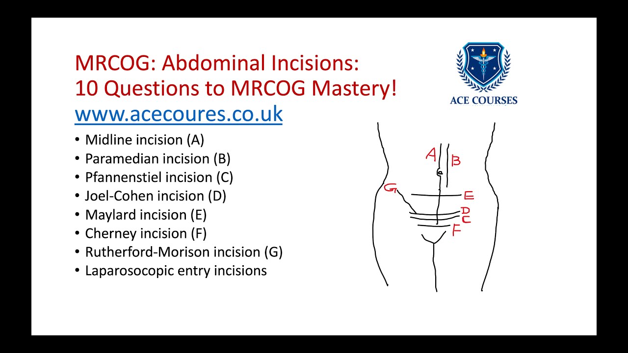 Abdominal incisions for the MRCOG exam. 'MRCOG Mastery in 10 Questions Series' from ACE Courses.
