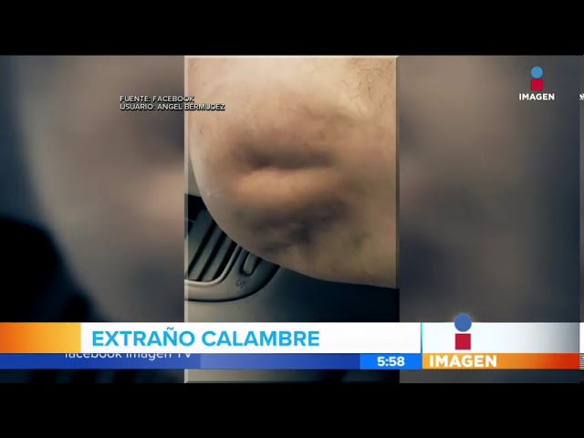 Calambres musculares: ¿por qué aparecen y cómo quitarlos fácilmente?