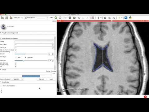 Software to convert CT Scan images on 3D Objects – Alan C. Assis