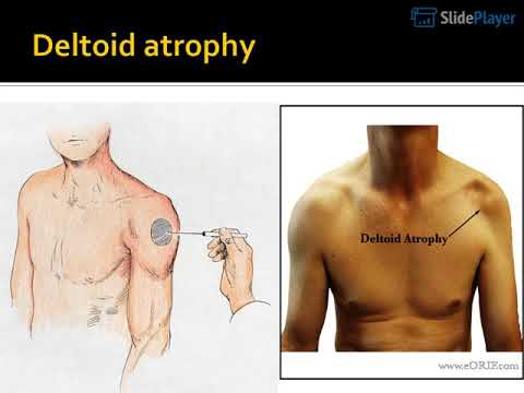 Complete upper limbs anatomy SlidePlayer ppt video