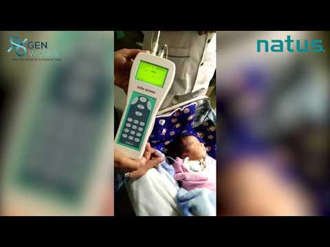 Otoacoustic Emission Machine - OAE Machine Latest Price, Manufacturers ...