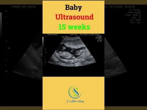 Baby Ultrasound 15 weeks Baby Movements #women #miracle #baby #pregnancy #pregnant #birth #babies