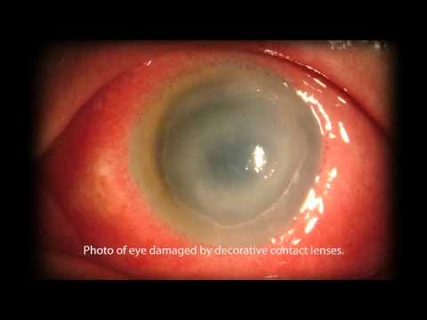 American Academy Of Ophthalmology