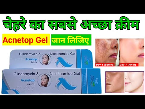 Clindamycin & Nicotinamide Gel - Clindamycin And Nicotinamide Gel ...