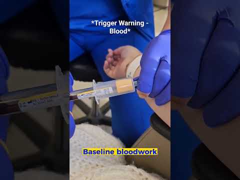 ACTH cortisol Stimulation Test