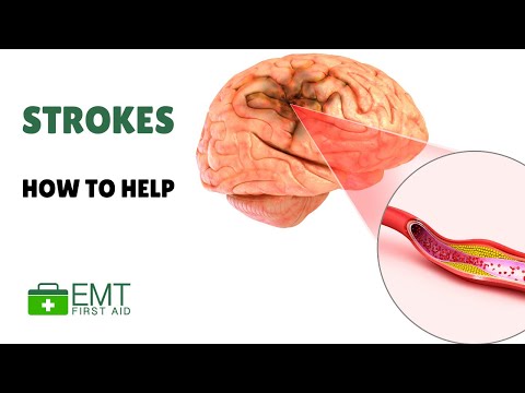 Ischemic + Hemorrhagic Strokes Symptoms and Treatment | Adult First Aid | EMT First Aid Training