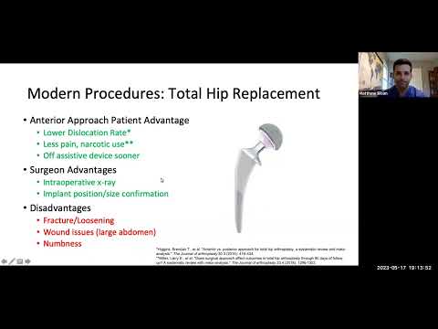 Robotics and Modern Approaches to Hip & Knee Replacement